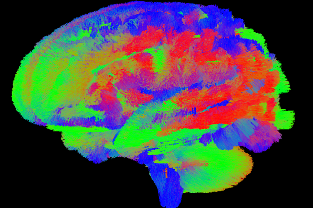 Amazing images show what happens in a newborn baby's brain Theirworld